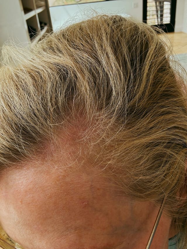 Revive Your Hair: Get Thick & Healthy Hair During Menopause